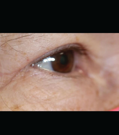 Before & After Gallery | Facial Plastic Surgery Results