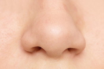 Information about empty nose syndrome
