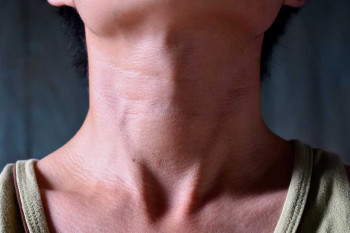 Why does my thyroid hurt?