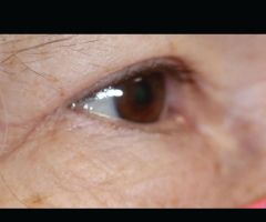 Before & After Gallery | Facial Plastic Surgery Results